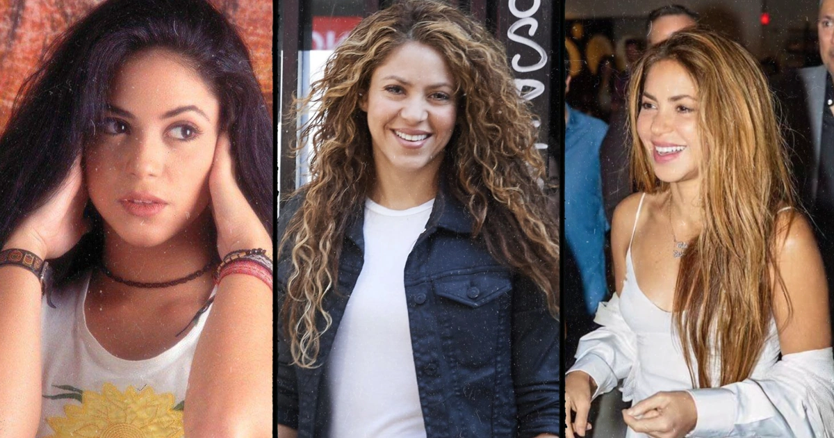 ¿Exceso de bótox? Shakira enfrenta varias críticas por su apariencia