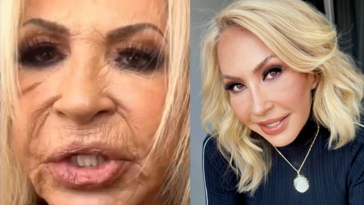 “Parecía un monstruo” dijo Laura Bozzo tras su cambio de imagen ...